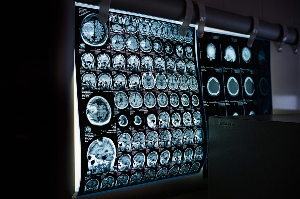 How an MRI Can Help Diagnose Injuries From a Car Accident